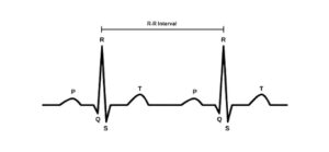 Intro to Heart Rate Variability - Morpheus